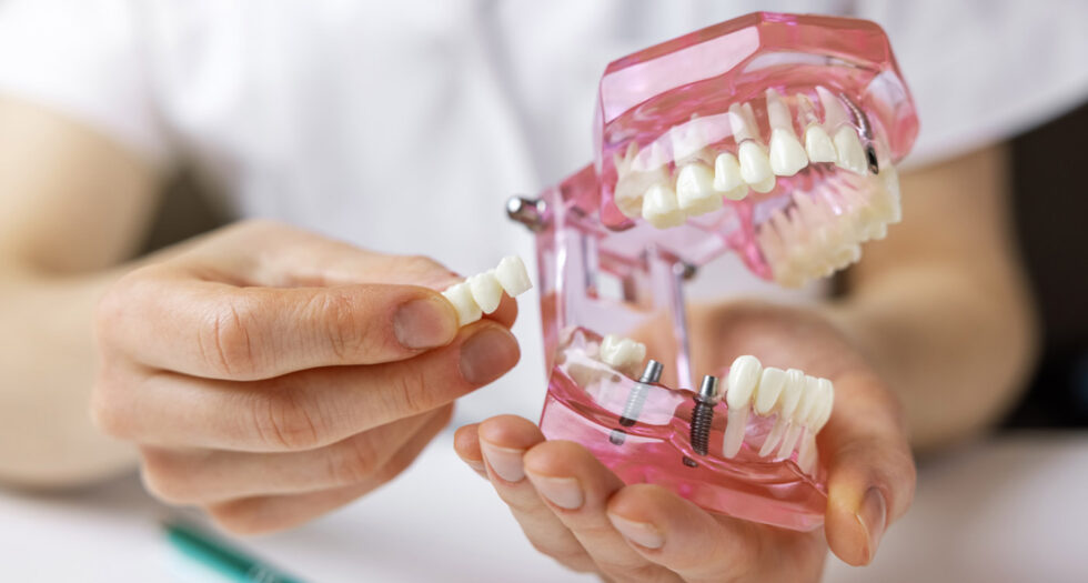 Restorative Dentistry - Palmetto Kids Dentistry and Orthodontics